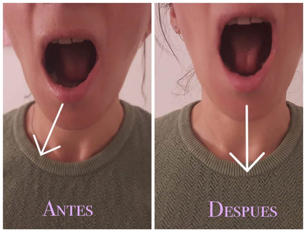 La importancia que tiene la ATM a nivel postural - Koena Salud